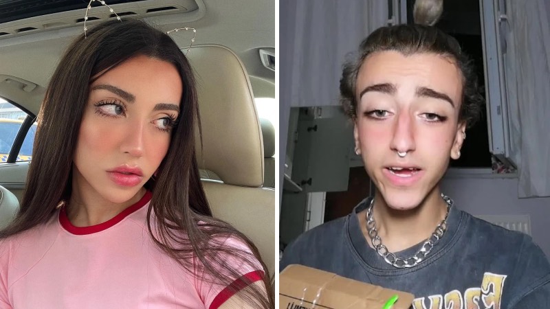 Cinsiyet uyum sürecini tamamlayan Mika Raun'un son hâli gündem oldu ...