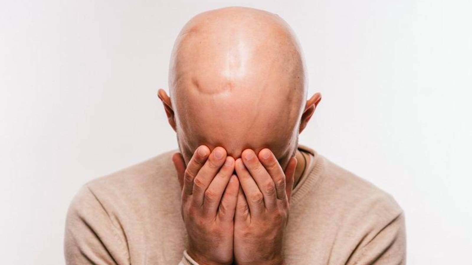 Kel olmak sanıldığı kadar dezavantajlı mı? - Fotoğraf Galerisi